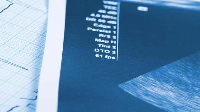 Significance of Prenatal Diagnosis for a Healthy Pregnancy