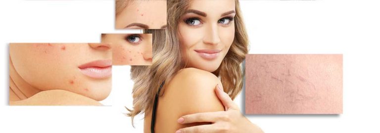 Common Skin Changes During Pregnancy - HealthyPregnancy.com