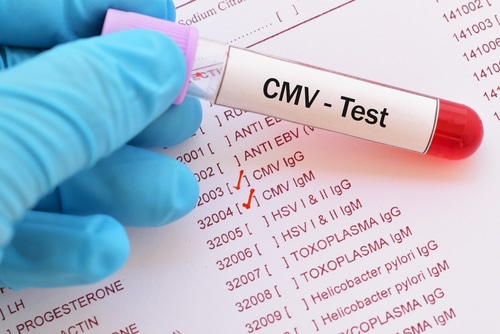 How Does Cytomegalovirus (CMV) Affect Pregnancy? - Healthy Pregnancy